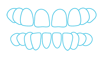 Spark™ - Innovatief en geavanceerd Clear Aligner-systeem