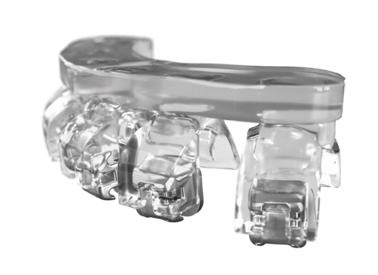 Ormco - 60 Years of Only Orthodontics. Let's Empower You!